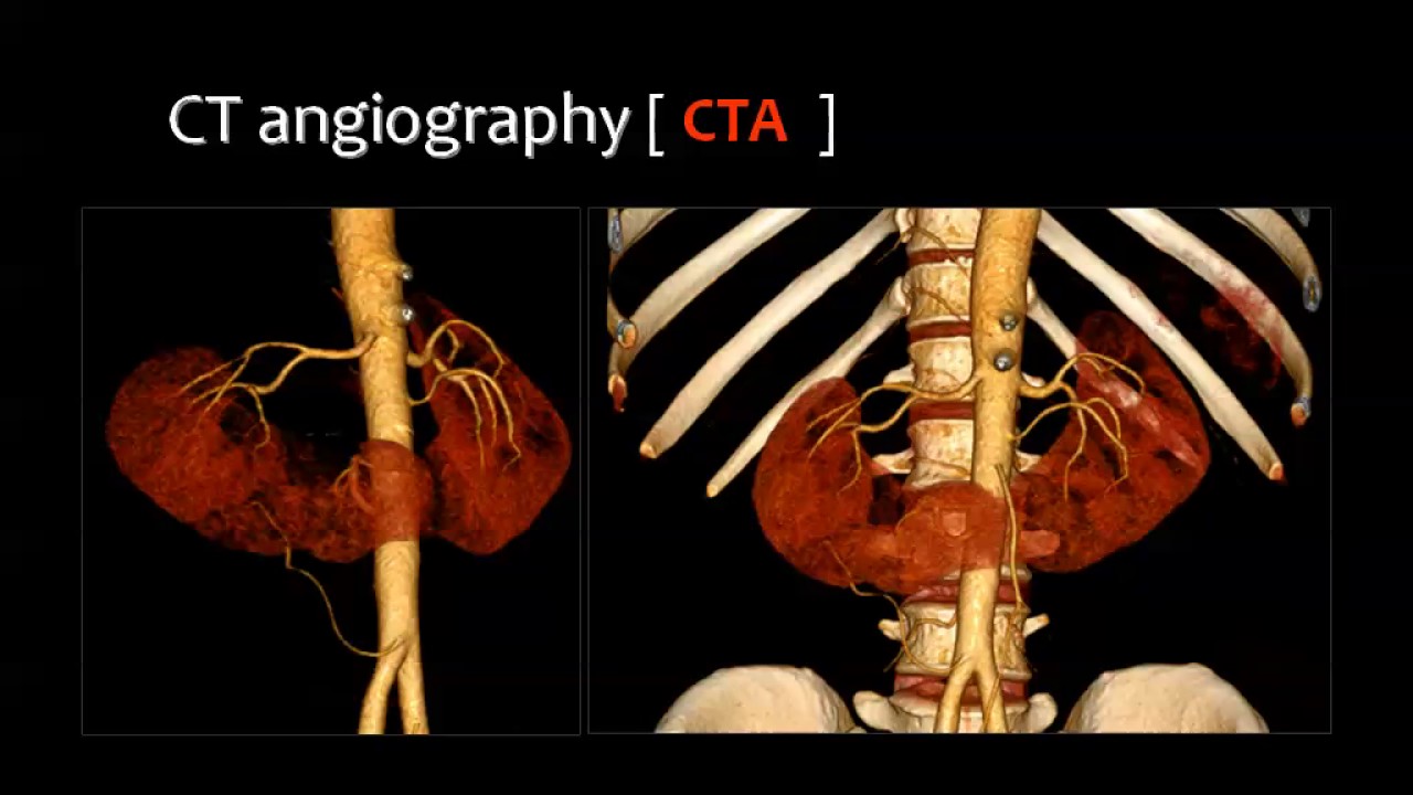 U.T Imaging Anatomy and Pathology - II - YouTube
