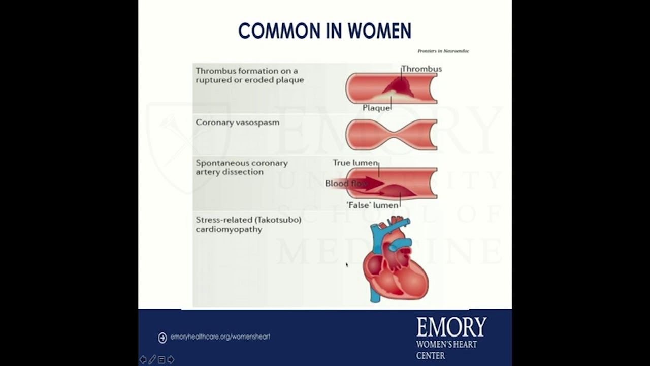 Emory Cardiology Grand Rounds 01-22-2018 - YouTube