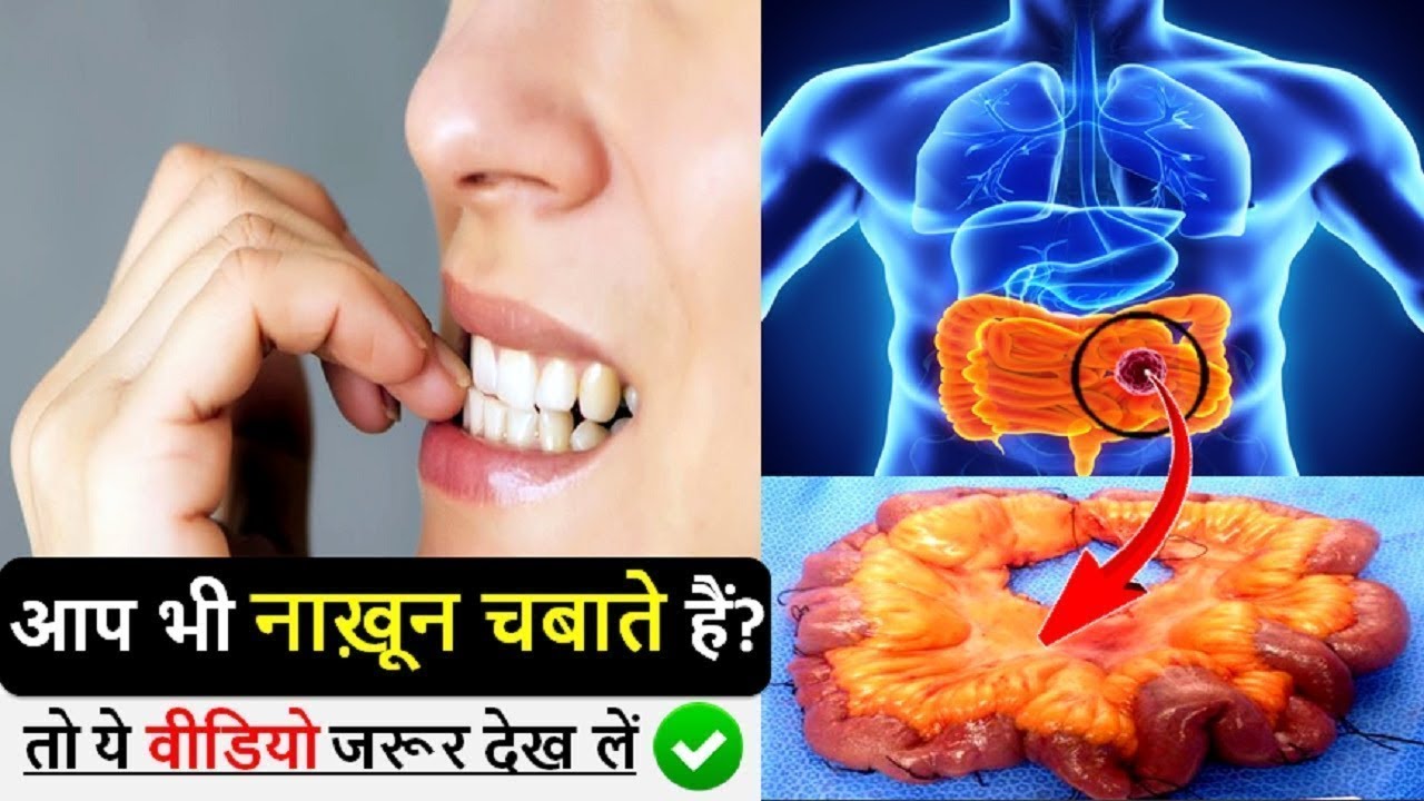 नाखून चबाने से होती है ये गंभीर बीमारियां, हो जाएं अलर्ट! Top 6 Nail ...