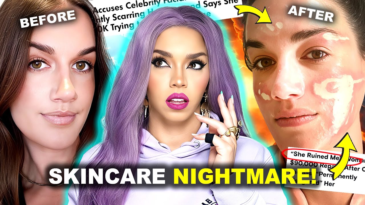 Viral TikTok EXPOSES Celebrity Esthetician: ‘She RUINED My Face ...