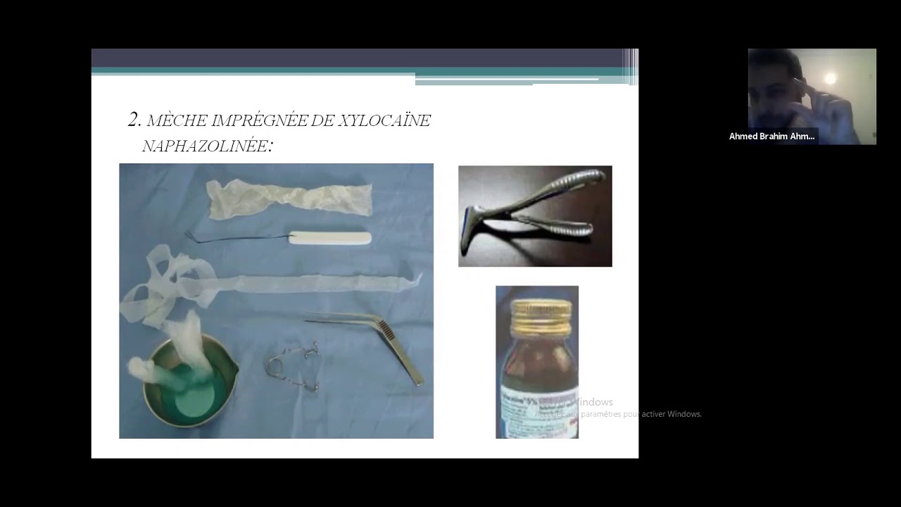 CAT Devant Une Epistaxis - YouTube