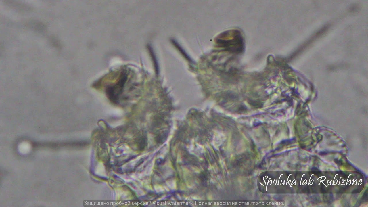 myobia musculi . богатый внутренний мир. - YouTube