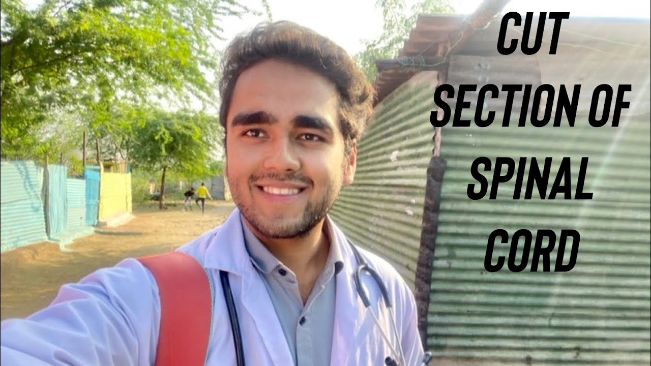 Transverse section of spinal cord at mid cervical level neuroanatomy ...