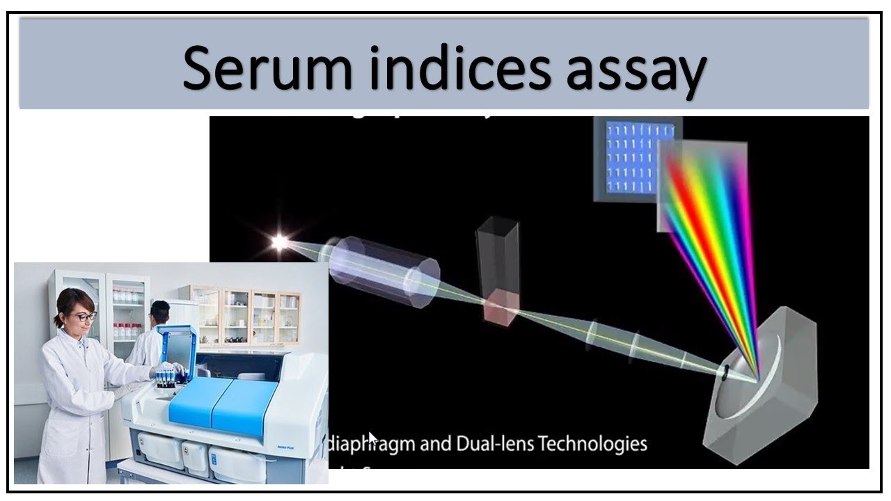 Serum indices assay .#Medilabacademy#HILindices#Biochemistry# ...