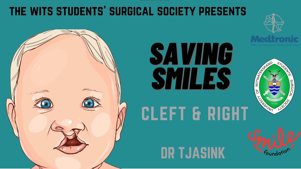 Saving Smiles Cleft and Right - YouTube