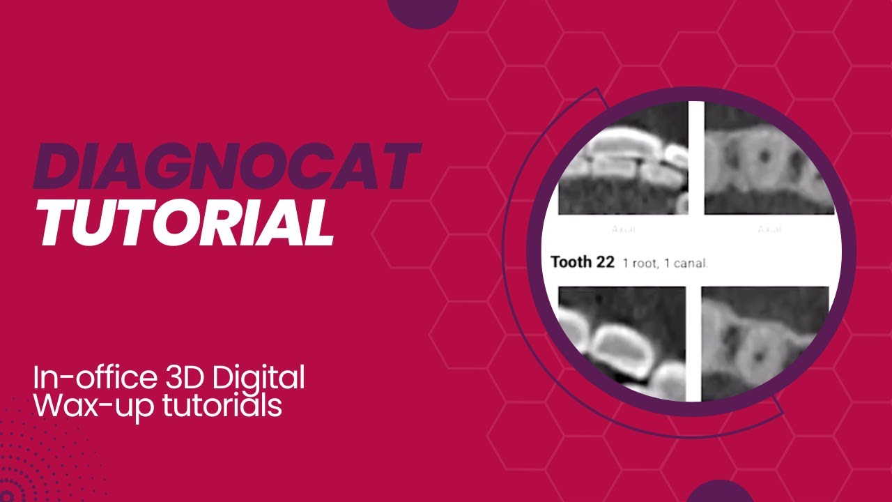 Diagnocat Tutorial - YouTube