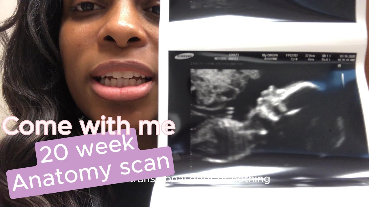 20 week Anatomy scan |Team Green | Placental Lakes - YouTube