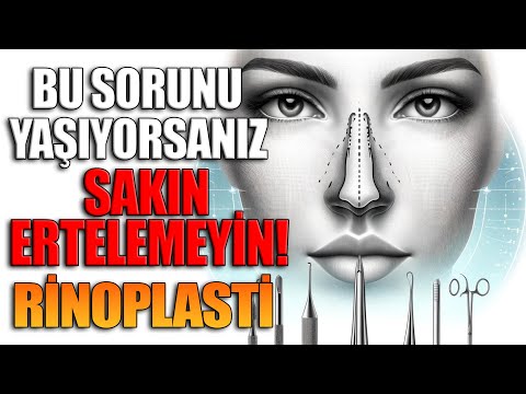 BU SORUNU YAŞIYORSANIZ SAKIN ERTELEMEYİN!