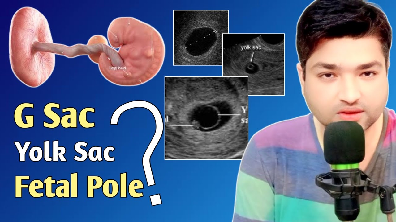 Gastational Sac Yolk Sac And Fetal Pole Ultrasound Complete Guide By gastational-sac-yolk-sac-and-fetal-pole-ultrasound-complete-guide-by
