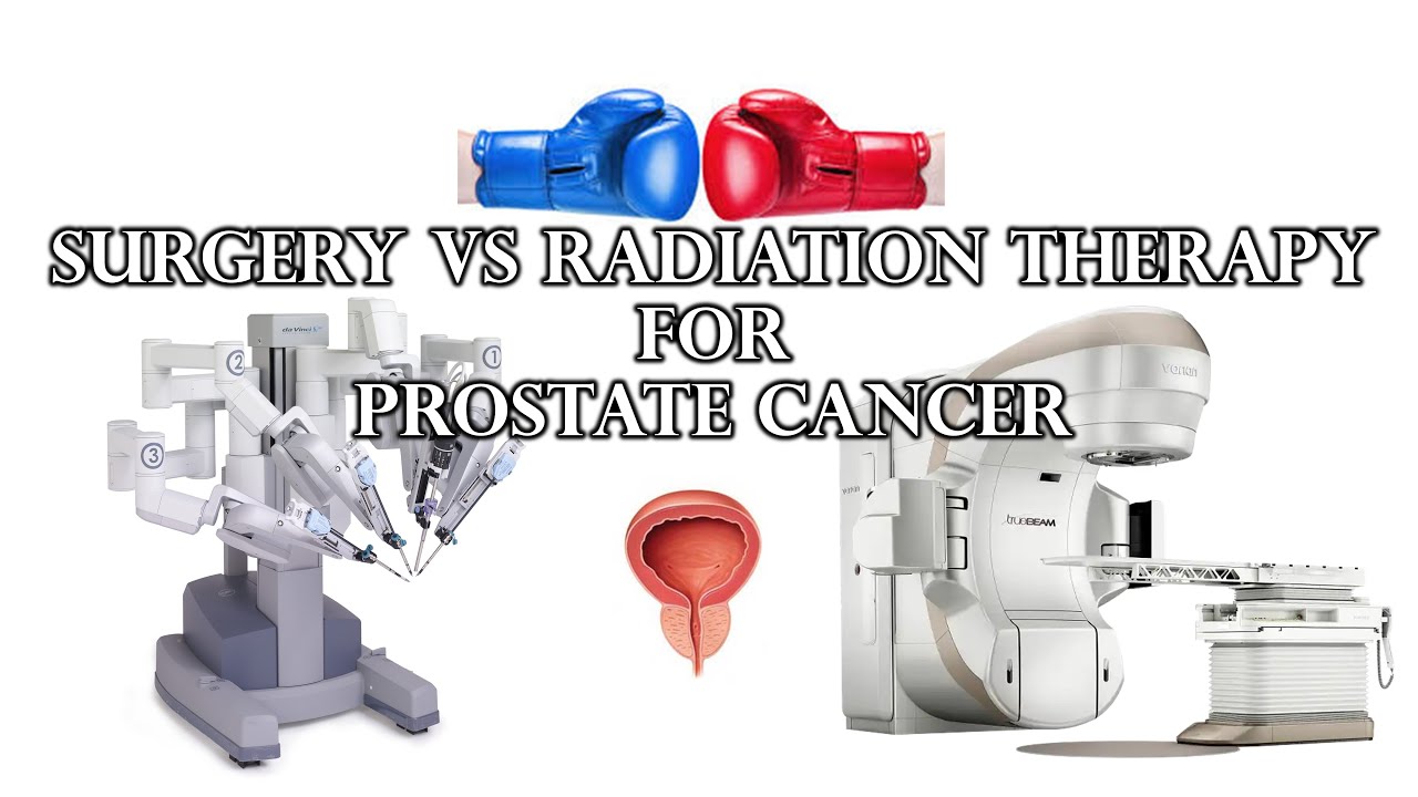 Surgery vs radiation therapy for prostate cancer - YouTube