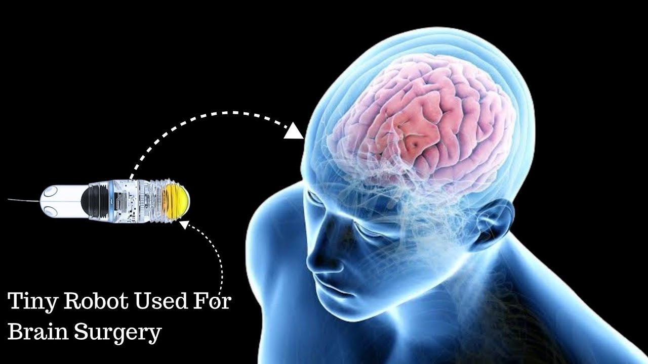 Is This Tiny Robot the Future of Brain Surgery? - YouTube