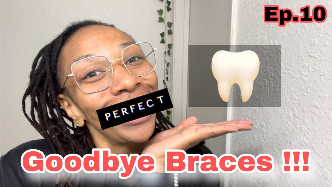 BRACES REMOVAL DAY • COME WITH ME • RETAINER CHECK • GOODBYE GAPS • THE ...