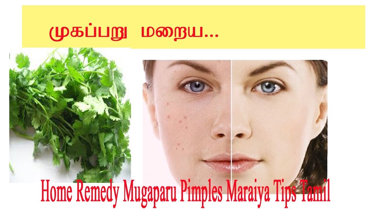 முகப்பரு மறைய - Cure Pimples Top Tips Mugaparu Pimples Maraiya Tips ...