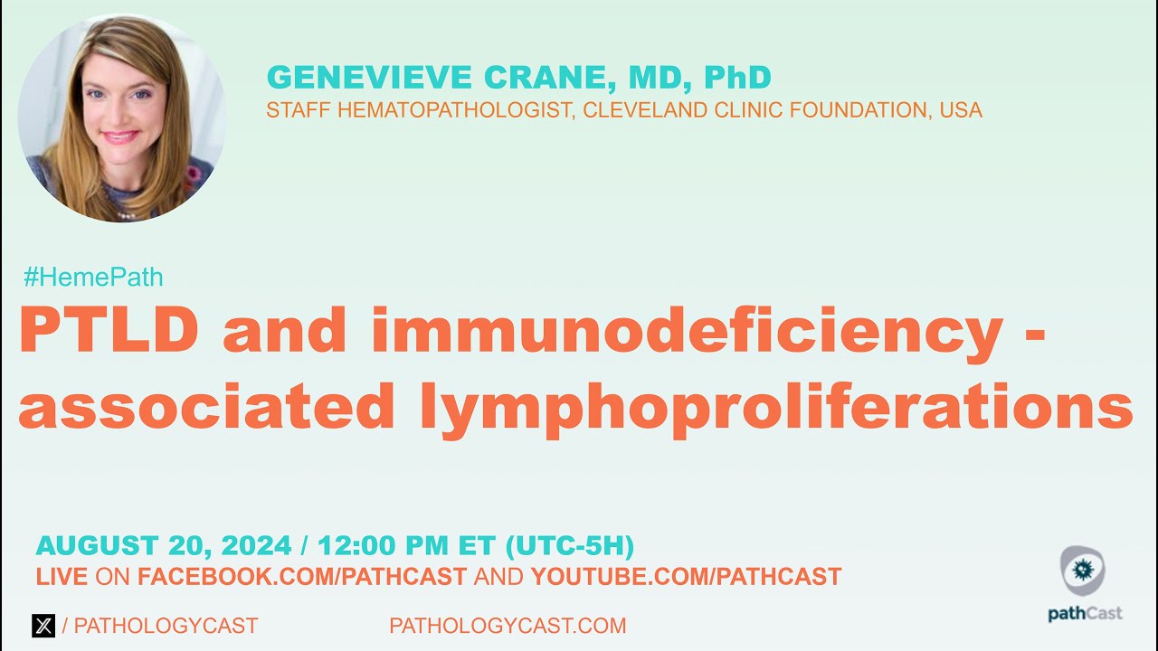#HEMEPATH PTLD and immunodeficiency- associated lymphoproliferations ...