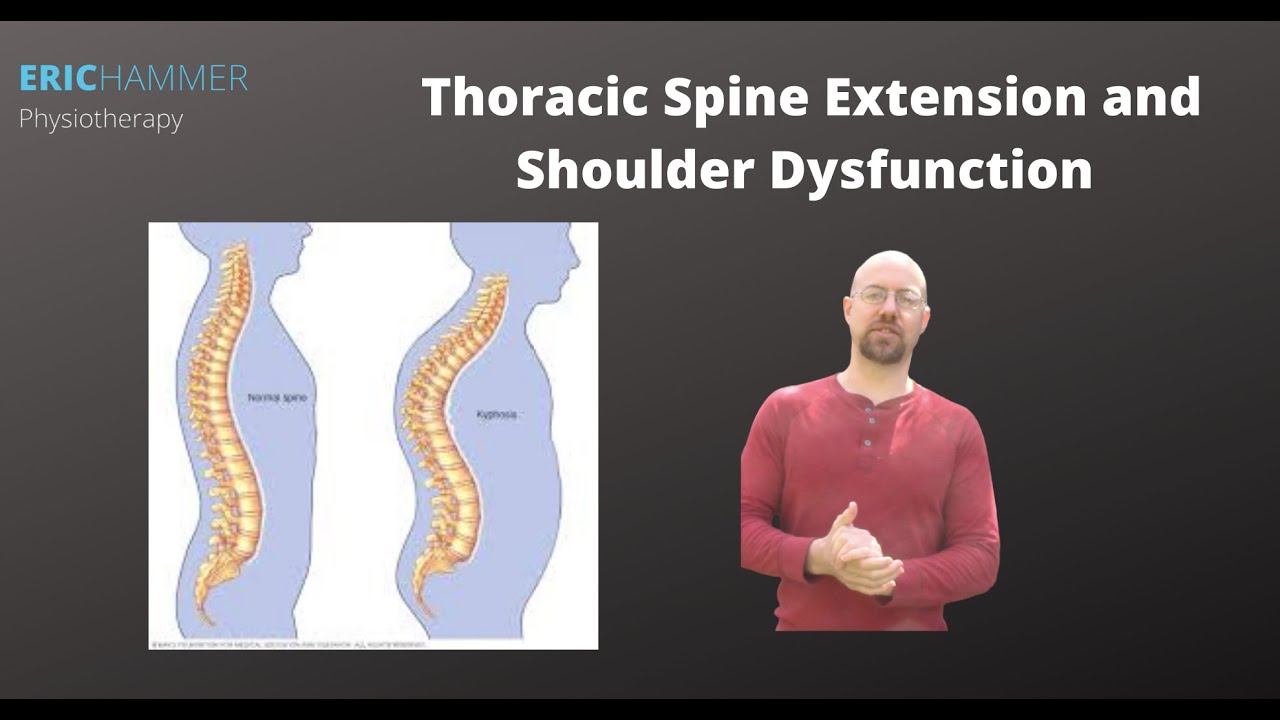 Thoracic Spine Extension and Shoulder Dysfunction - YouTube