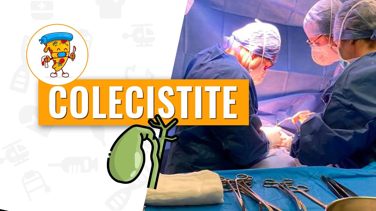 Colecistite acuta: tutto quello che devi sapere - Acute care surgery ft ...