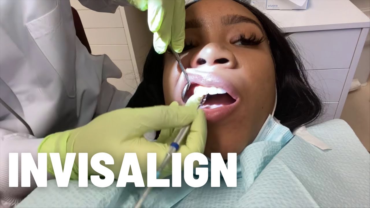 INVISALIGN RESULTS + CHRISTMAS LIGHT SHOW 2020 - YouTube