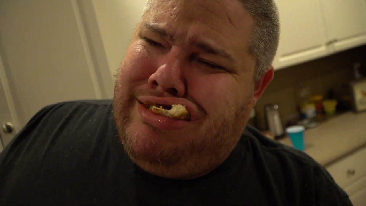 MY ROTTEN TEETH GET PULLED!! - YouTube