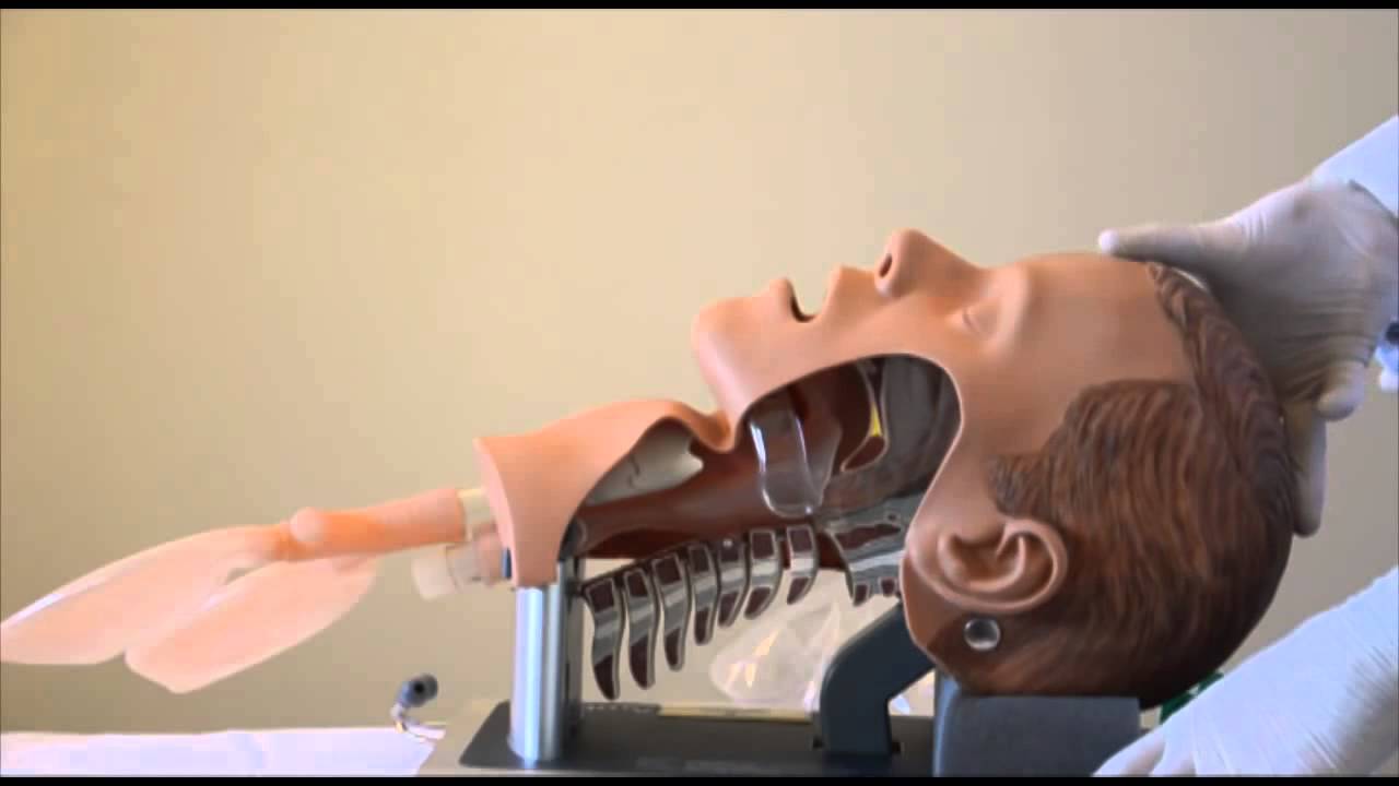 Intubación Orotraqueal IOT y manejo de la vía aérea1 - YouTube