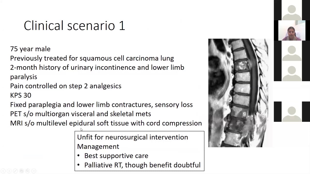 Spine SBRT by Dr Shikha - YouTube