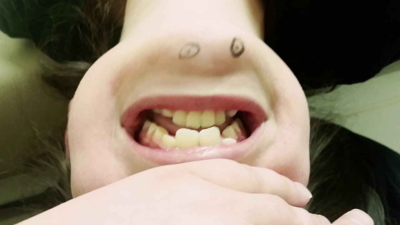 Keira's Chin Music - YouTube