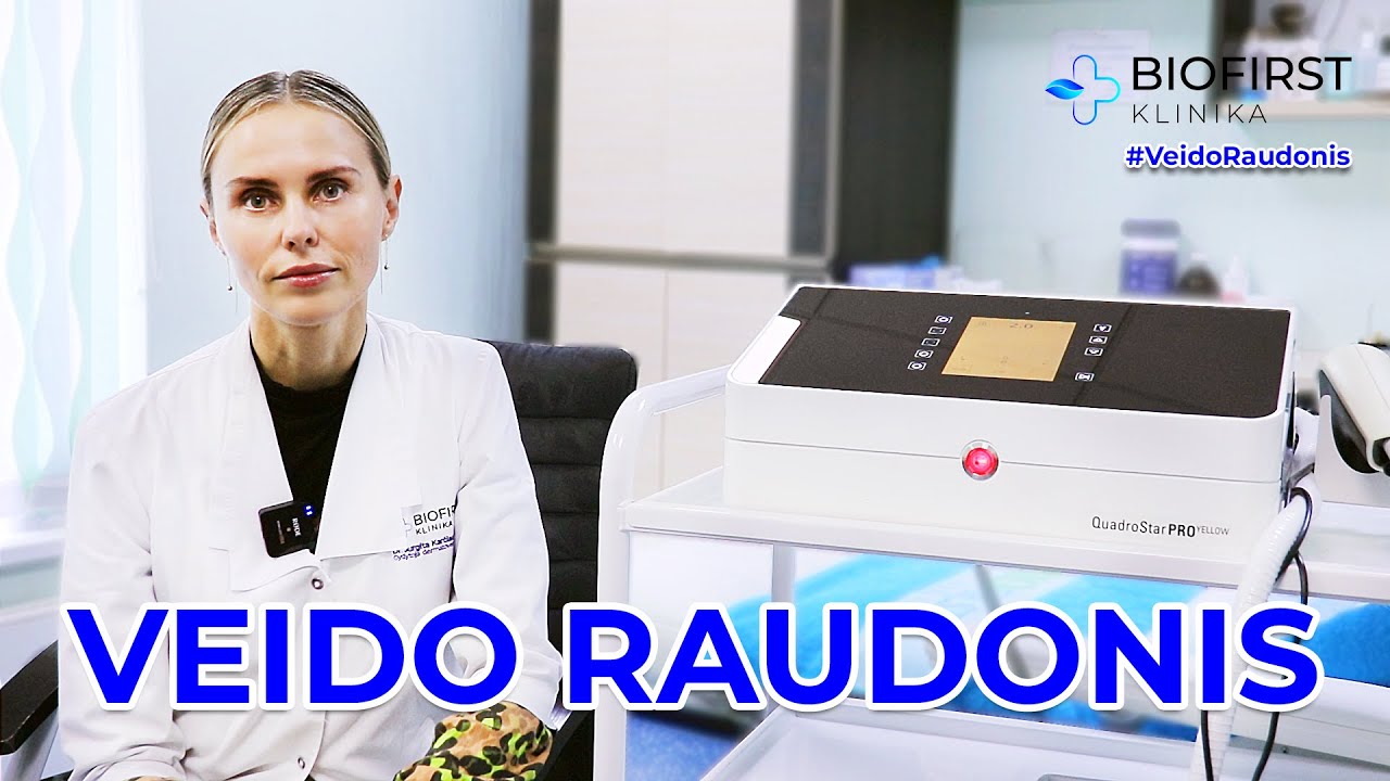 Veido raudonis: nuo ko atsiranda ir kaip jį gydyti? | dr. Jurgita ...