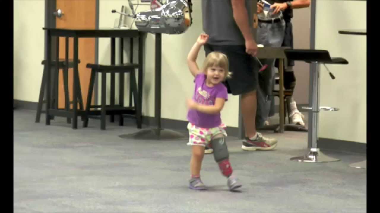 Playtime is Part of the Prosthetic Fitting Process for POA Kids! - YouTube