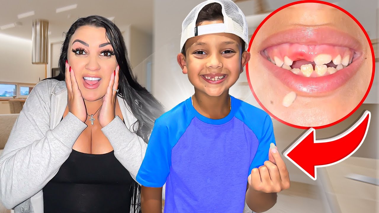 He LOST Another TOOTH... - YouTube