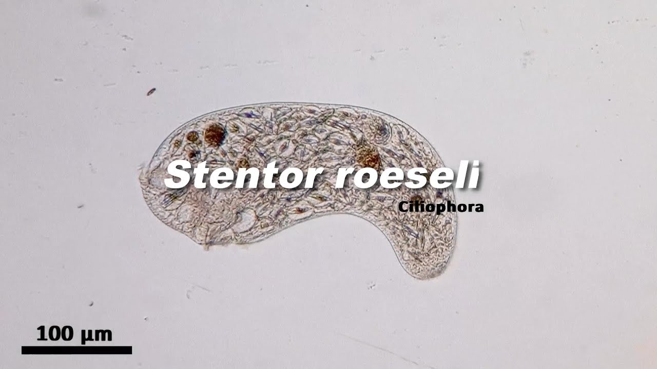 Stentor roeseli (Ciliophora) - YouTube