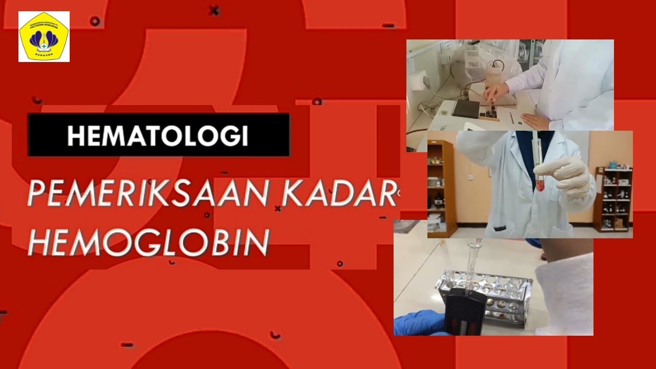 Pemeriksaan Kadar Hemoglobin Metode Sahli dan Sianmethemoglobin - YouTube