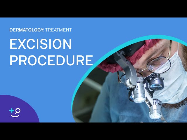 What Is Excision