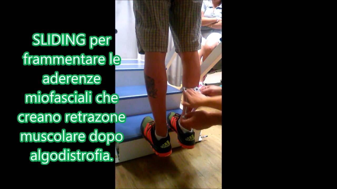 Algodistrofia post frattura del perone ed utilizzo del PHYSIOBLADE ...