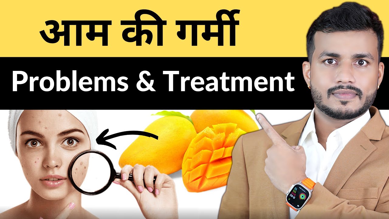 Mango Heat-skin problems treatment आम खाने से Pimples (फोड़ी-फुंसी ...