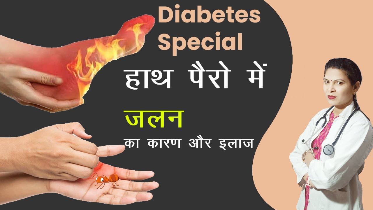 पैरो में जलन🔥 क्यू होती है | Pairo Me Jalan Ka Ilaj | Burning Feet ...