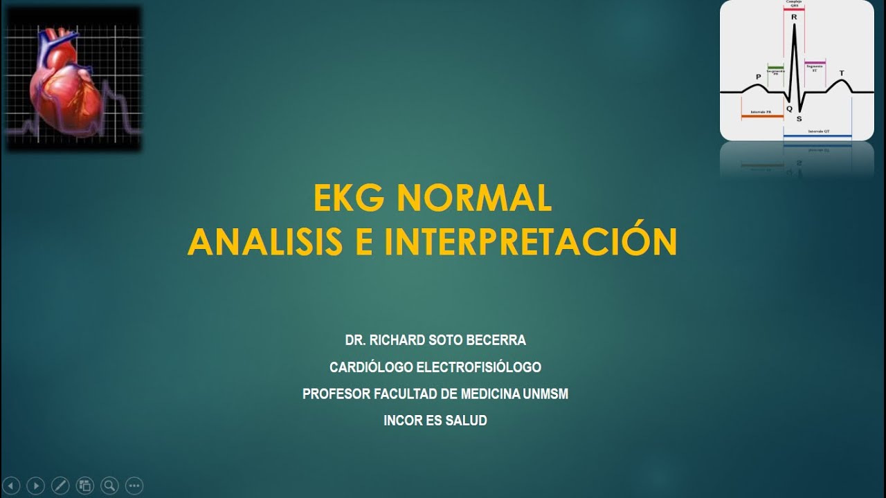 SESIÓN 5 INTERPRETACIÓN DEL EKG NORMAL - YouTube