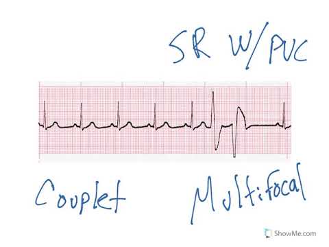 EKG Review Summer 2017 - YouTube