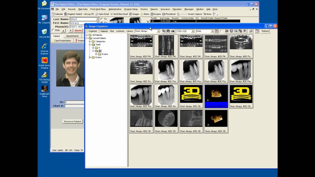 CBCT Integration to Carestream & J. Morita in TDO Software - YouTube