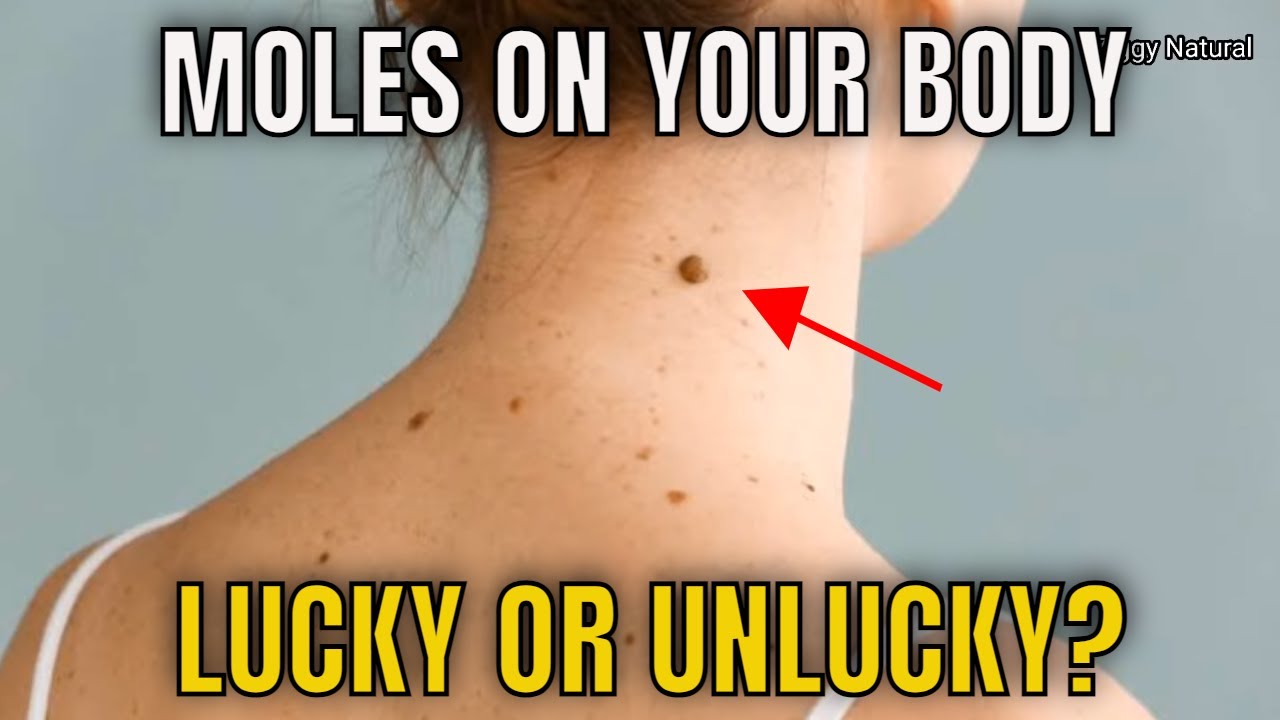 Meanings Of Moles On Different Parts Of The Body - Are They Lucky or ...