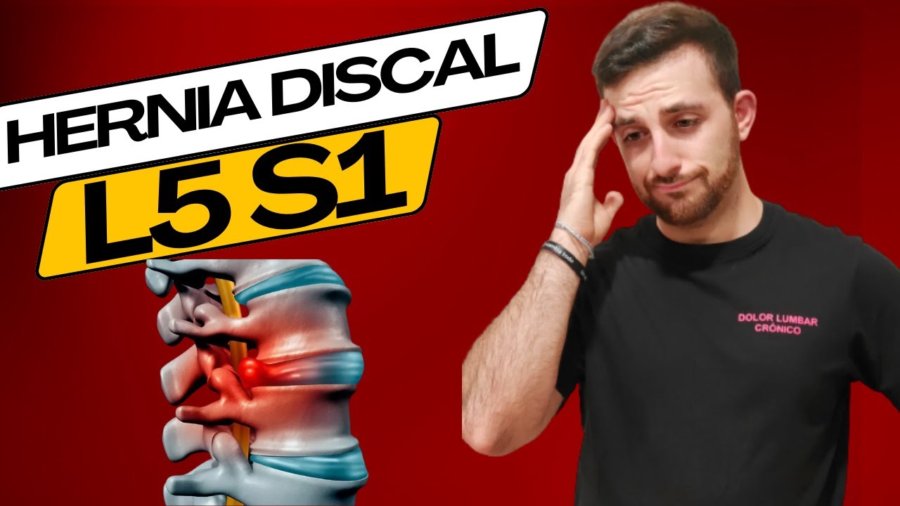 HERNIA DISCAL L5 S1 😮 MEJORA tu dolor lumbar 💯 - YouTube