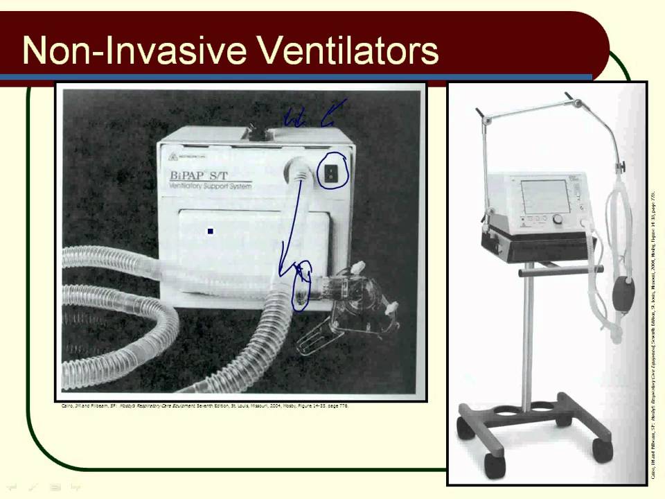 Noninvasive Mechanical Ventilation.avi - YouTube