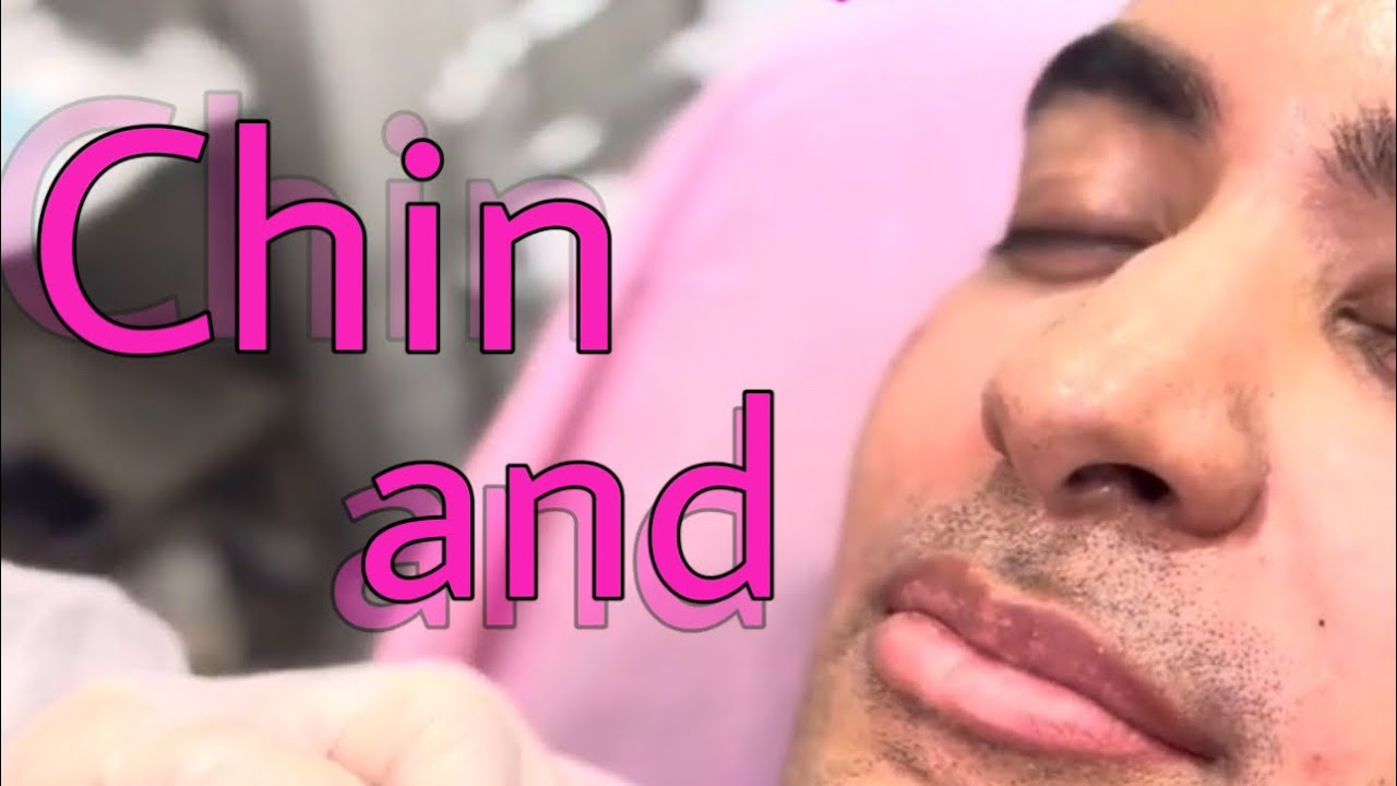 Cheek, Chin and Jawline 𝗳𝗼𝗿 𝗼𝘂𝗿 𝗴𝗼𝗿𝗴𝗲𝗼𝘂𝘀 𝗽𝗮𝘁𝗶𝗲𝗻𝘁 📐 - YouTube