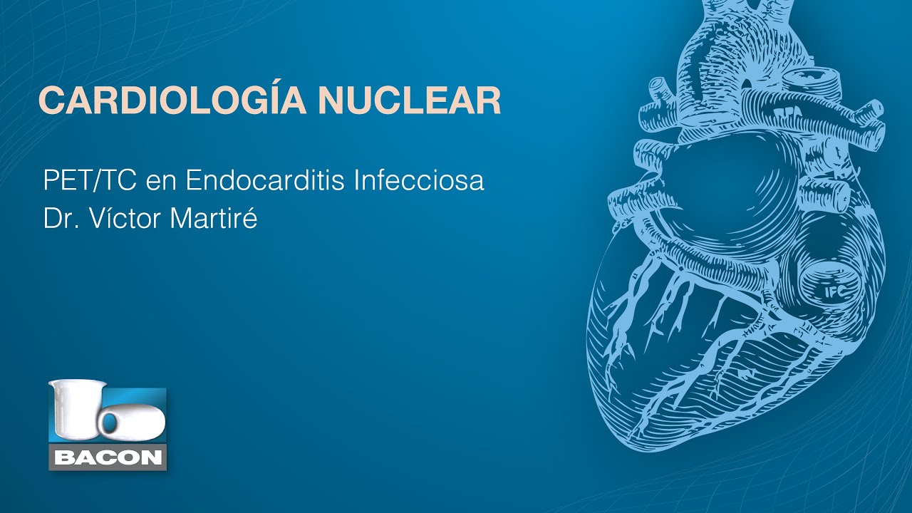 Pet/TC en Endocarditis Infecciosa - YouTube