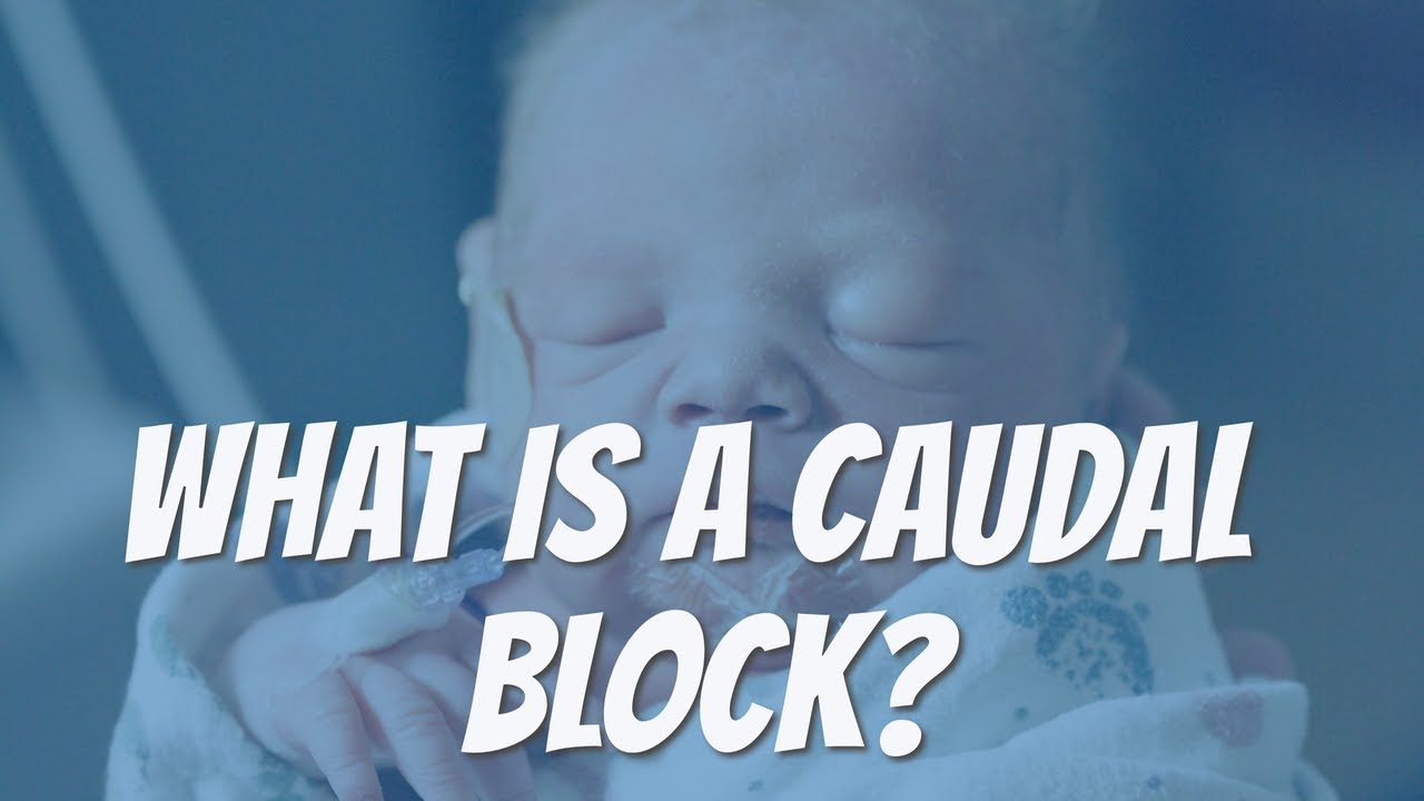 WHAT IS A CAUDAL BLOCK? - YouTube