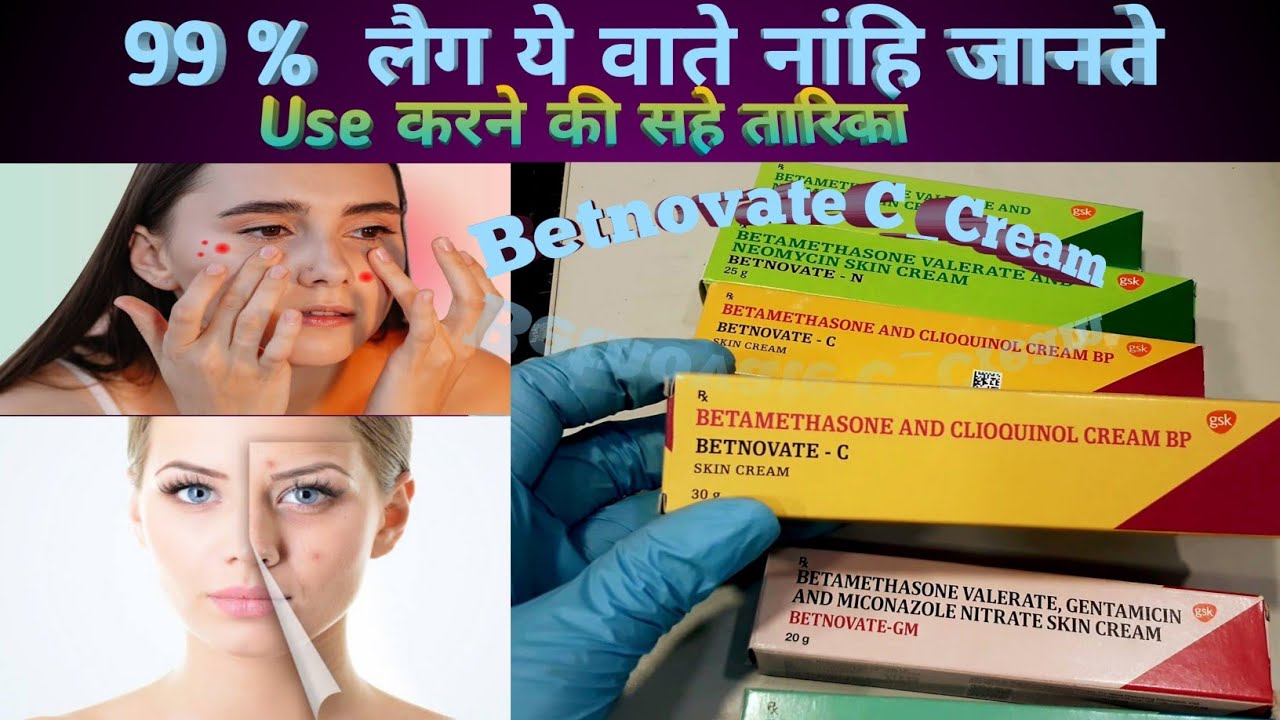 Betnovate c cream | benovate c cream Very Fast Result | use benefit ...