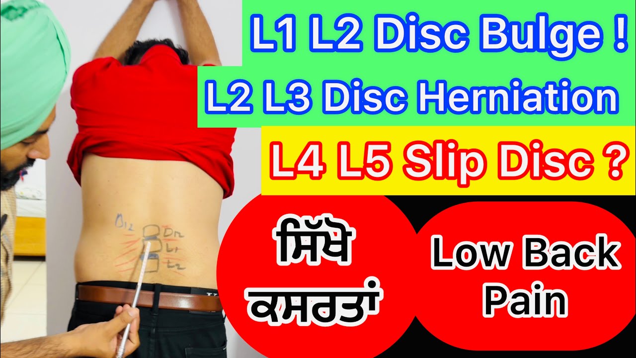 L3 L4 L5 Disc Bulge Exercises??? L4 L5 Disc Slip or Disc Herniation ...