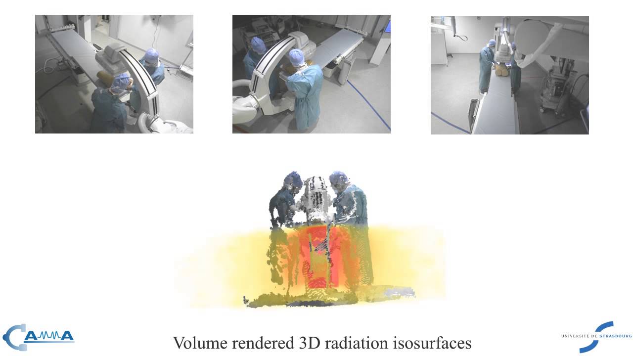 3D Global Estimation and Augmented Reality Visualization of Intra ...