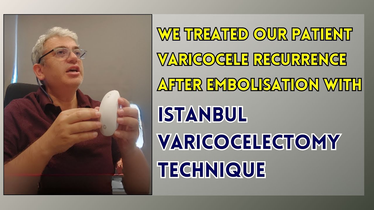 Varicocele Recurrence after Embolization: We treat him with our ...
