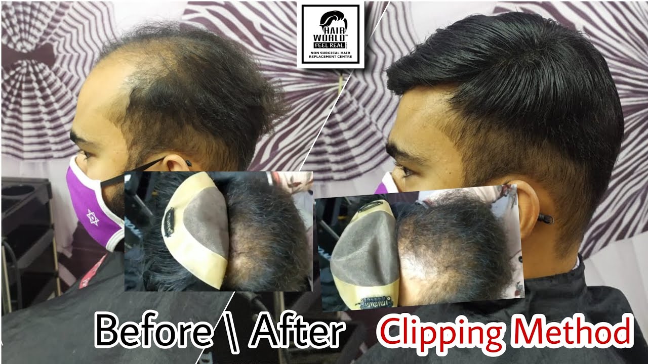 Clipping Hair Fixing For Men | Clipping Hair Patch For Men | Hair Wig ...