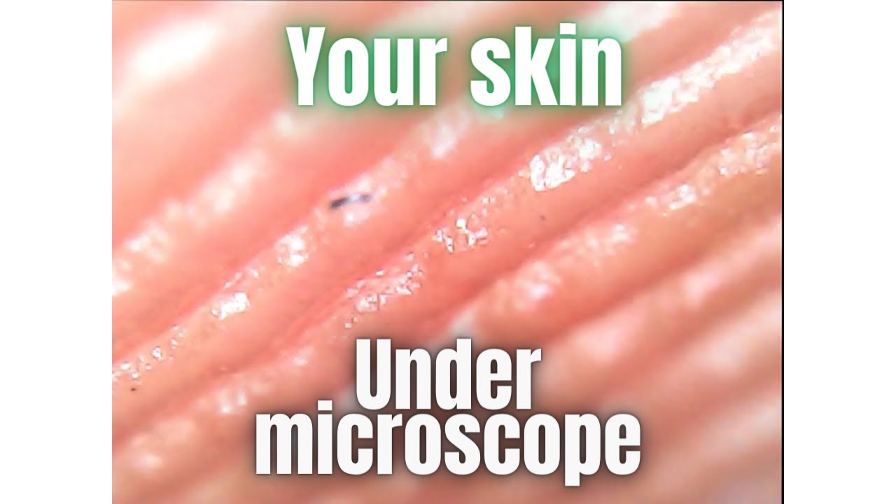 How does your skin looks under a microscope? | It isn't pretty! - YouTube