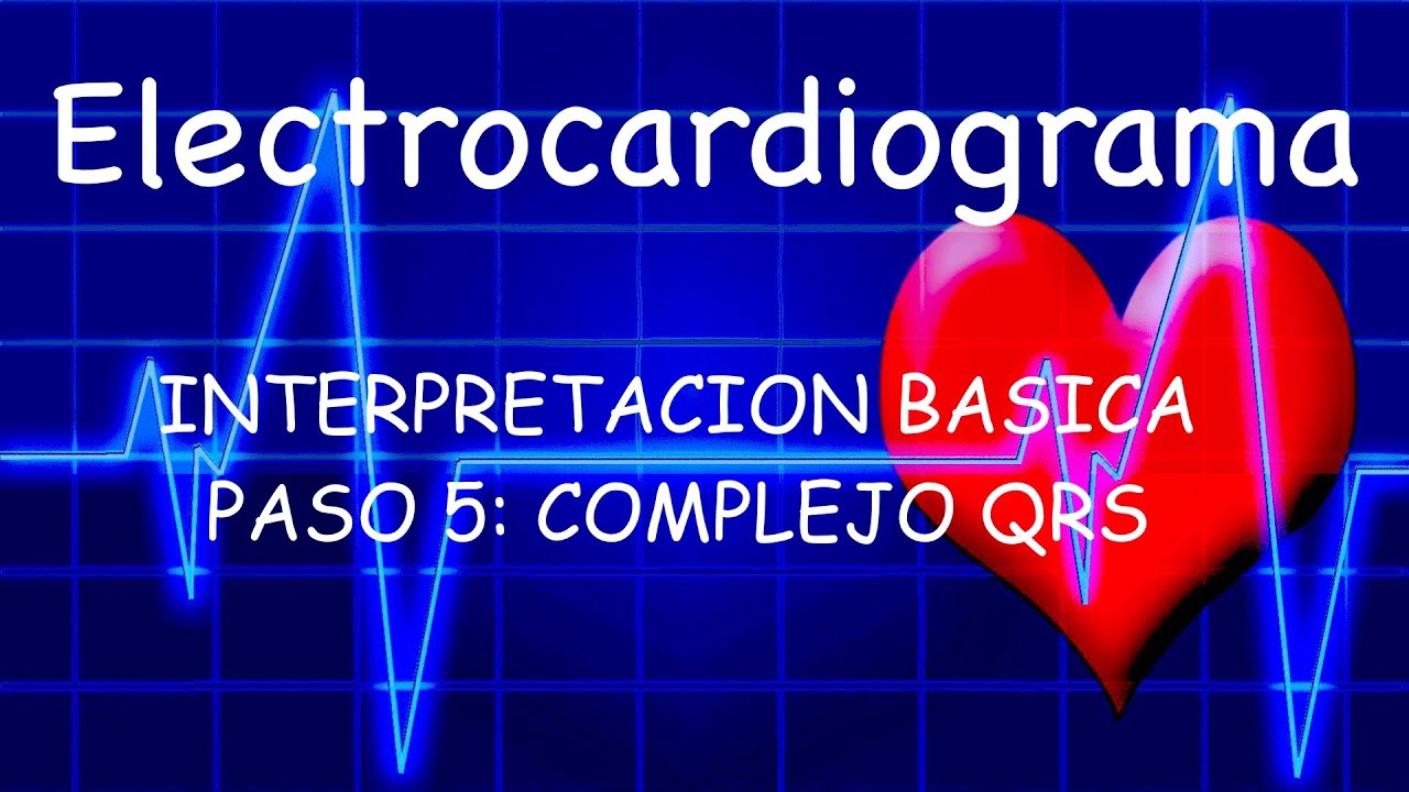 Electrocardiograma Básico: Complejo QRS - YouTube